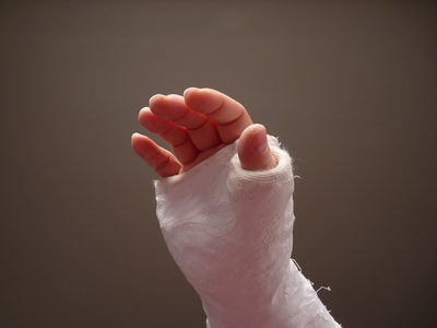 Fracture de la main : symptômes, traitement, définition - docteurclic.com