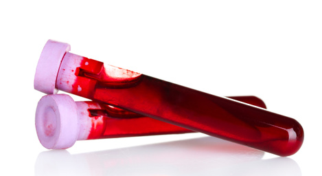 Plasma sanguin : définition - docteurclic.com