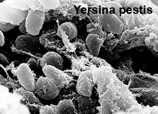 Peste : symptômes, traitement, définition - docteurclic.com