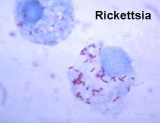 Typhus : symptômes, traitement, définition - docteurclic.com