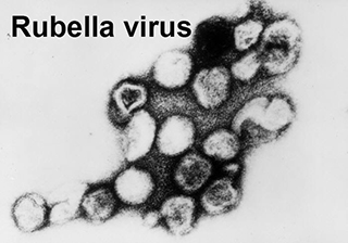 Rubéole de l'adulte : symptômes, traitement, définition - docteurclic.com