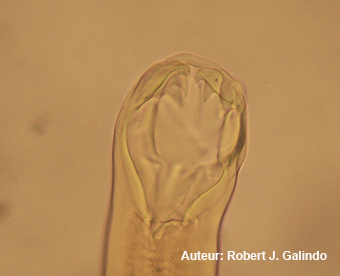 Ankylostomose : symptômes, traitement, définition