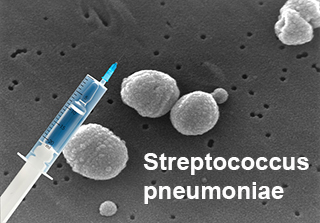 Vaccin anti-pneumococcique : traitement, définition - docteurclic.com