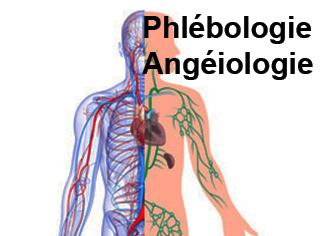 Ulcère variqueux : symptômes, traitement, définition - docteurclic.com