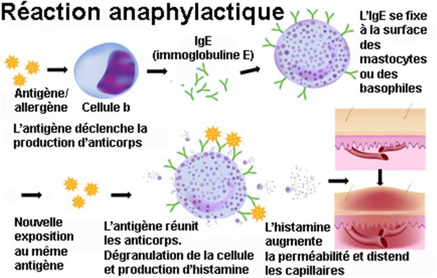 Mécanisme de l'allergie : définition - docteurclic.com Mécanisme de l'allergie : définition - docteurclic.com