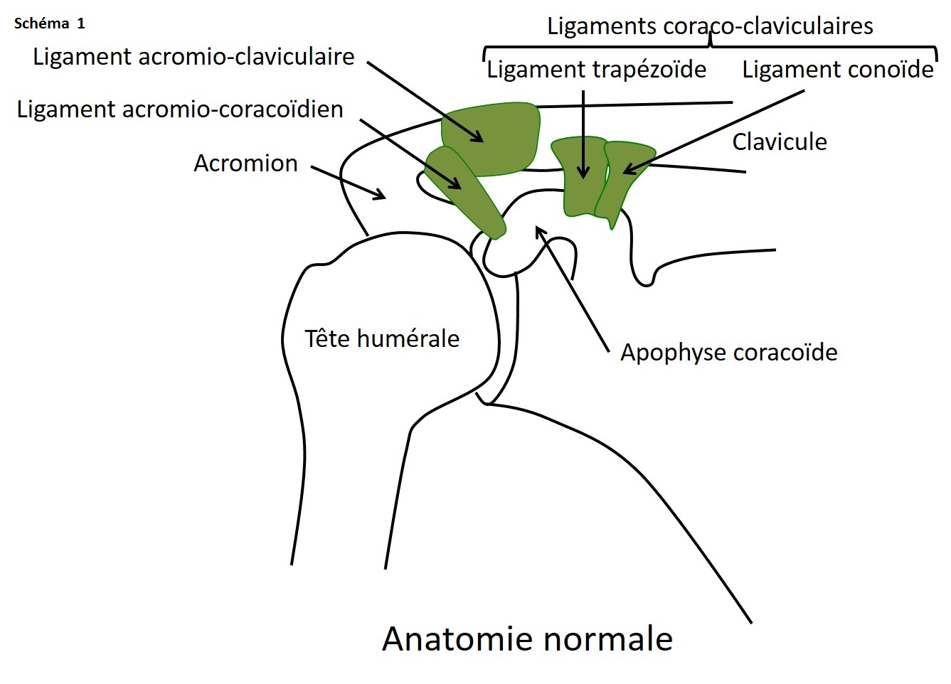 Disjonction acromio-claviculaire : définition - docteurclic.com